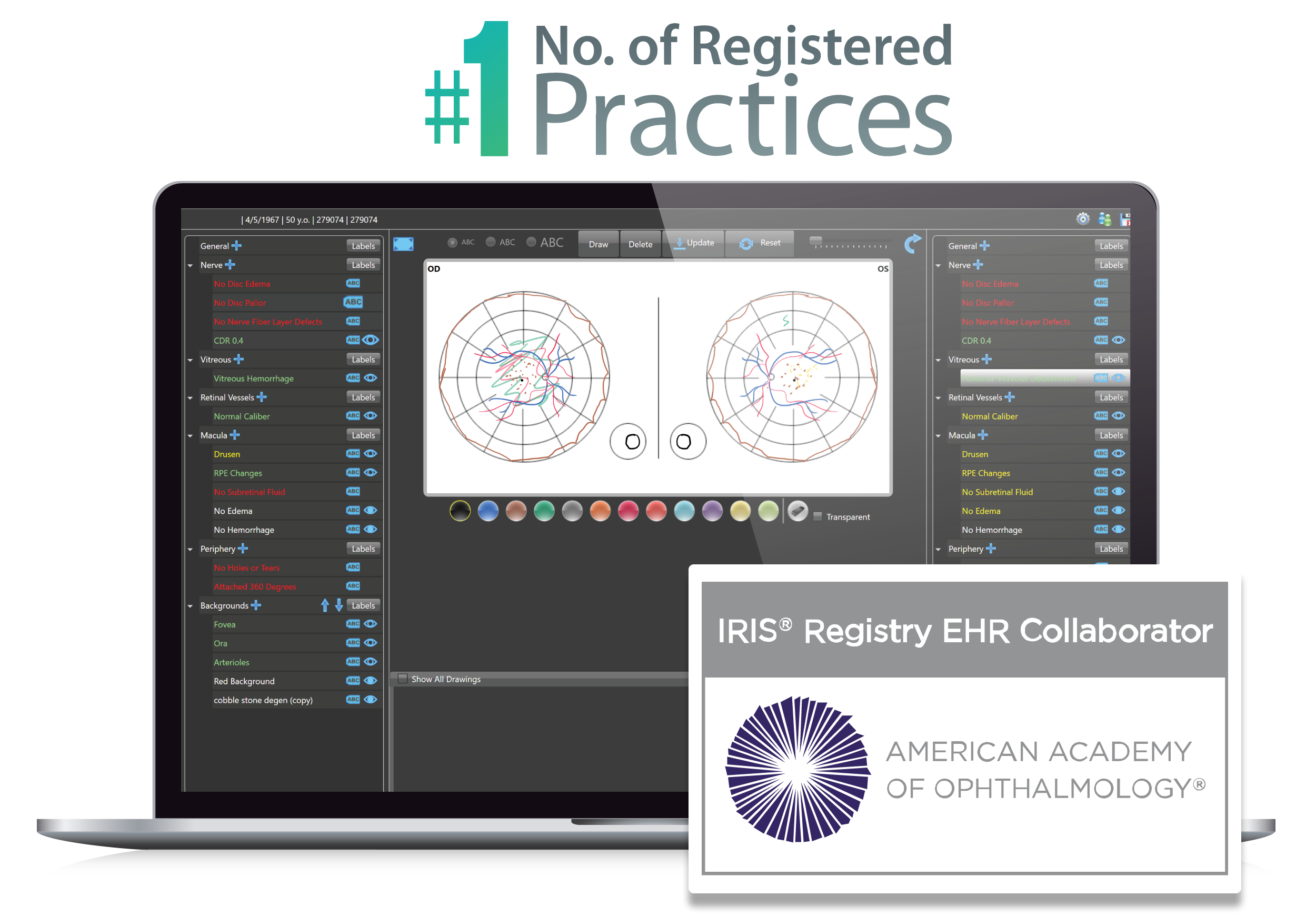 Ophthalmology EHR & Practice Management Software | Nextech