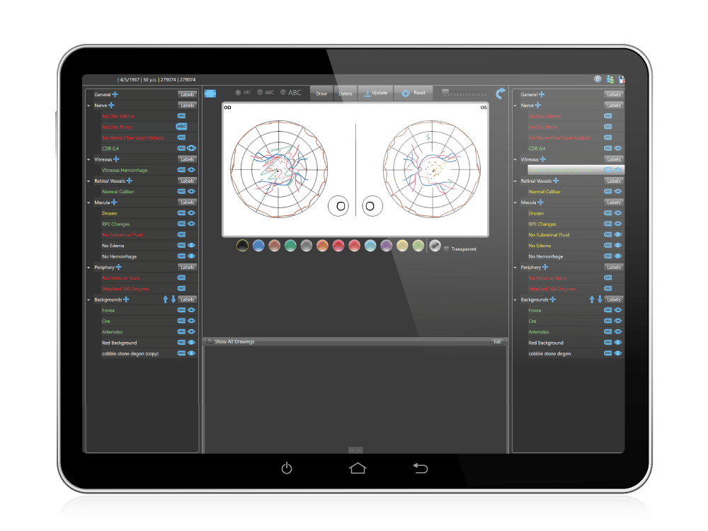 Ophthalmology EHR Systems & Practice Management Solutions | Nextech