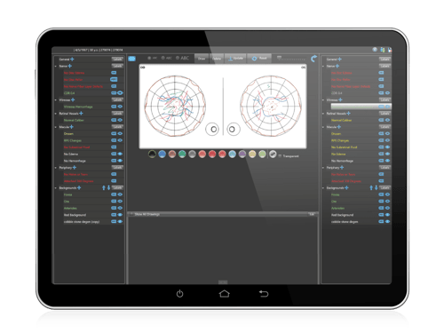 Ophthalmology EHR Systems & Practice Management Solutions | Nextech